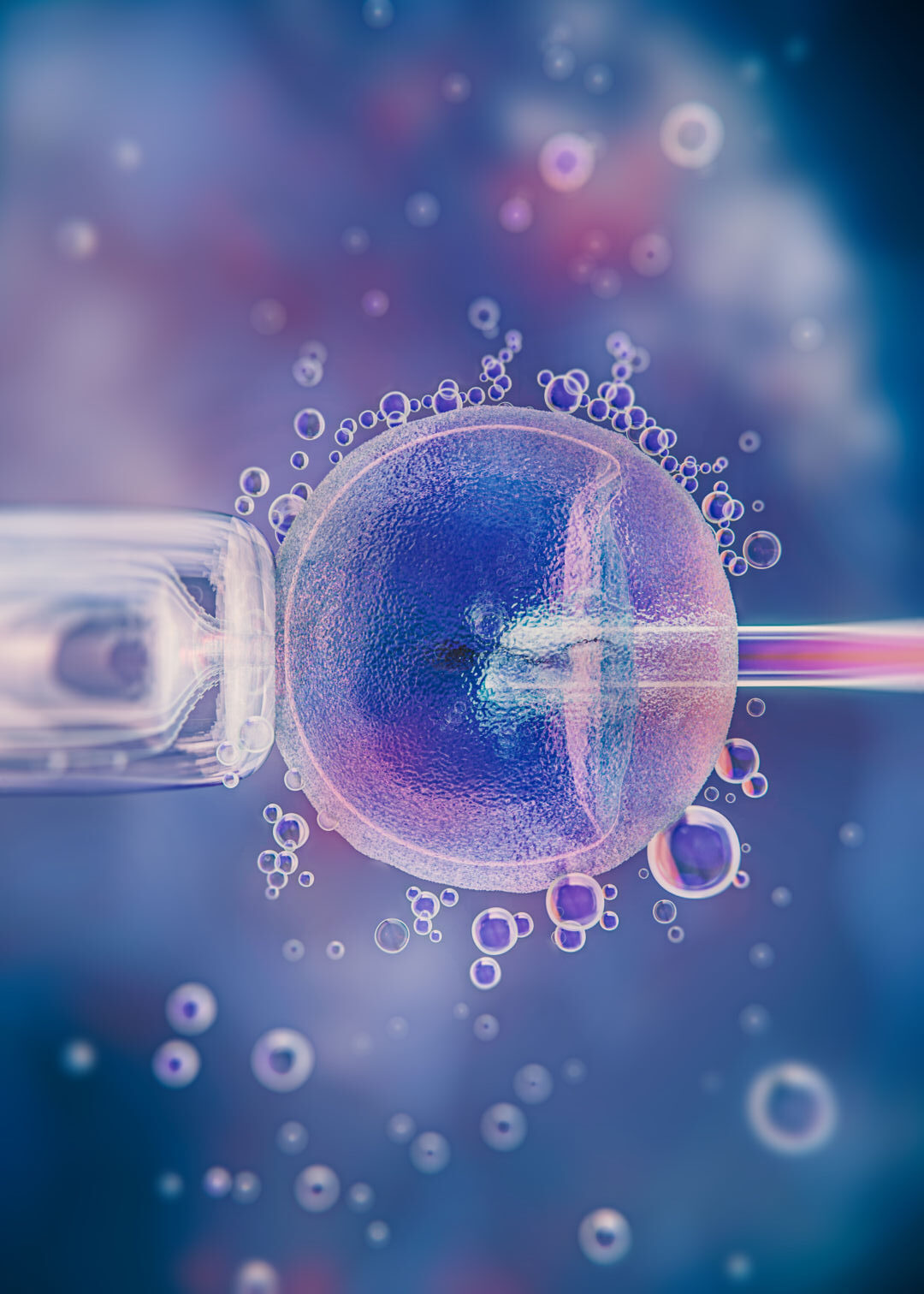 IVF for all, but not for LGBTI people - MIIR